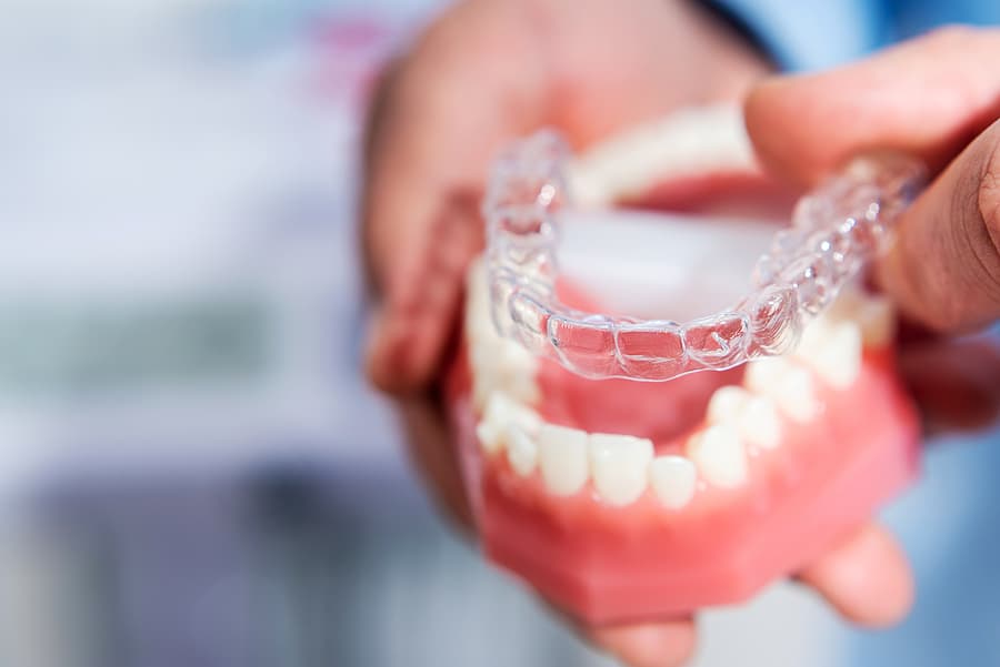Can Invisalign fix crossbite more comfortably? When you choose ...